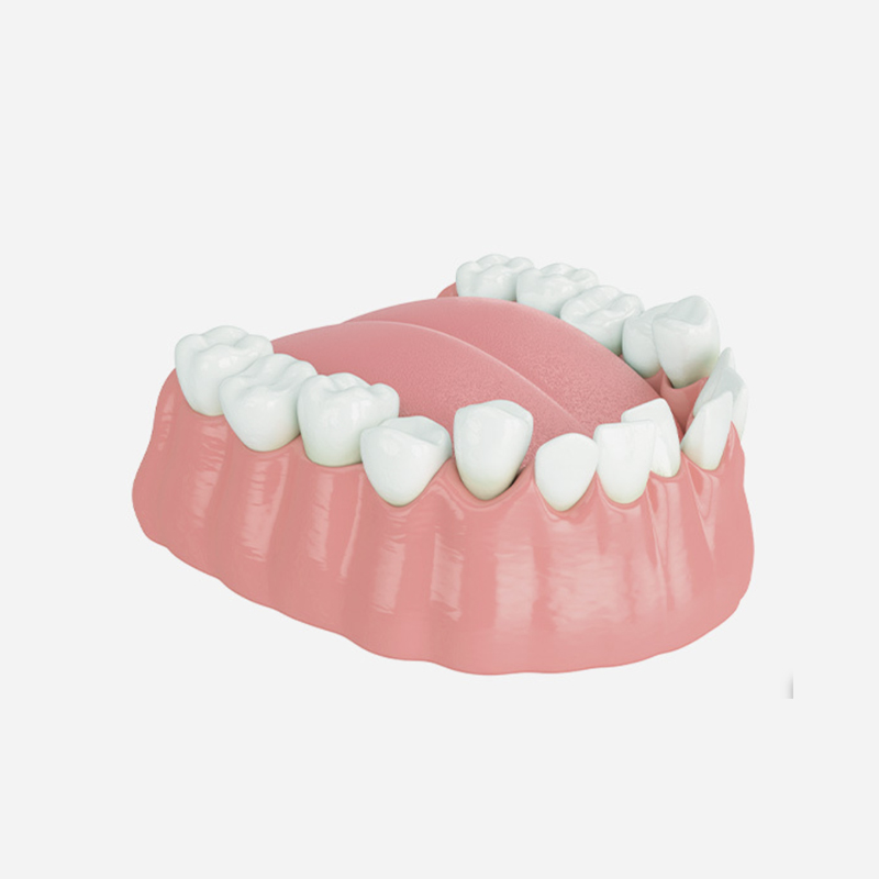 Mira Clinic | How to choose the right veneers? Comprehensive guide