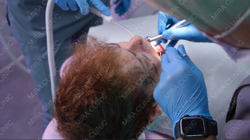 Hollywood Smile Review in Turkey – Carina Stunning’s Experience at Mira ...