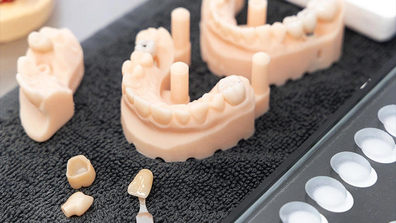 Mira Clinic | Smile Makeover vs Hollywood Smile in Turkey (2026): What ...